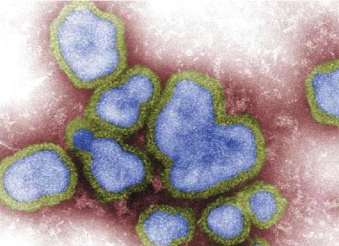 Cambodia Reports 14th Human H5N1 Bird Flu Infec...