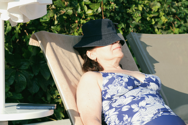 Heat Rash Vs. Sun Poisoning: What To Look For A...