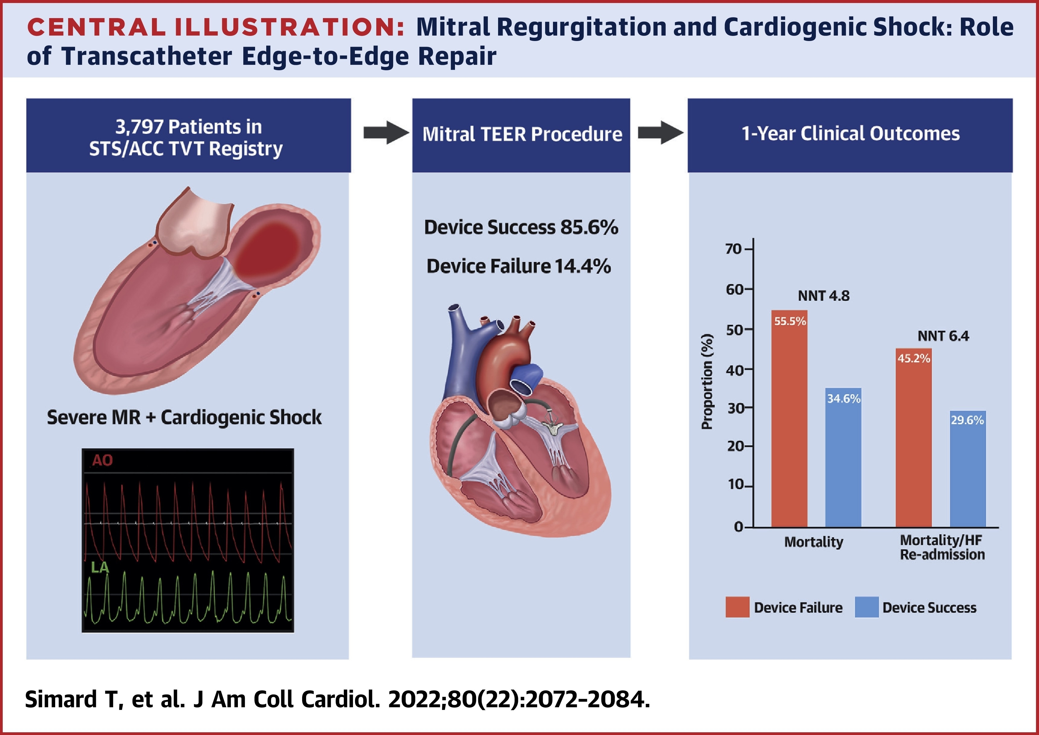 Transcatheter Edge-to-Edge Mitral Valve Repair ...