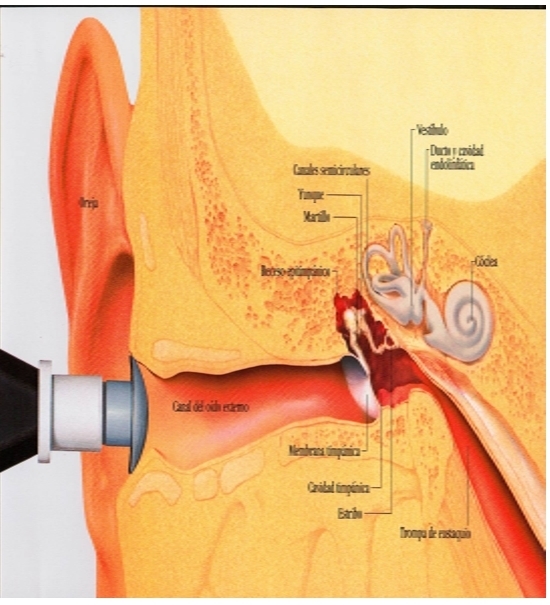 El reflejo estapedial - Centro Auditivo Cuenca,...