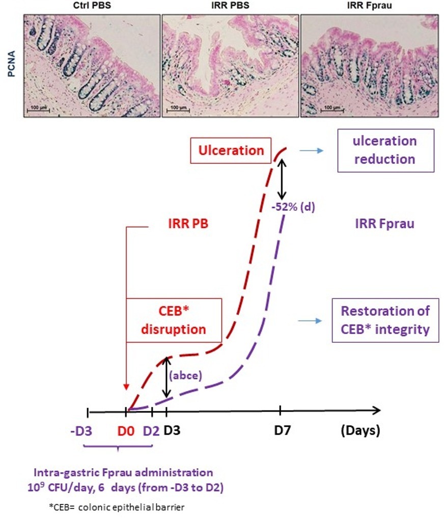 Un traitement prophylactique par Faecalibacteri...