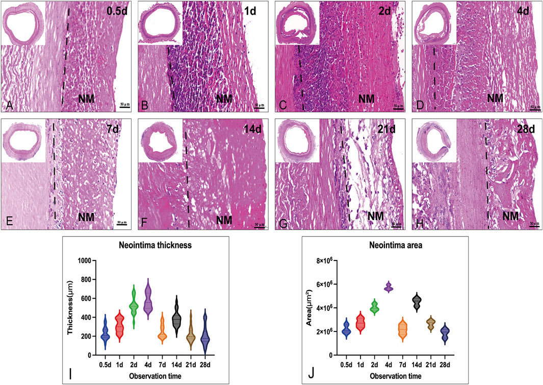 Proteomics analysis of neointima formation | In...