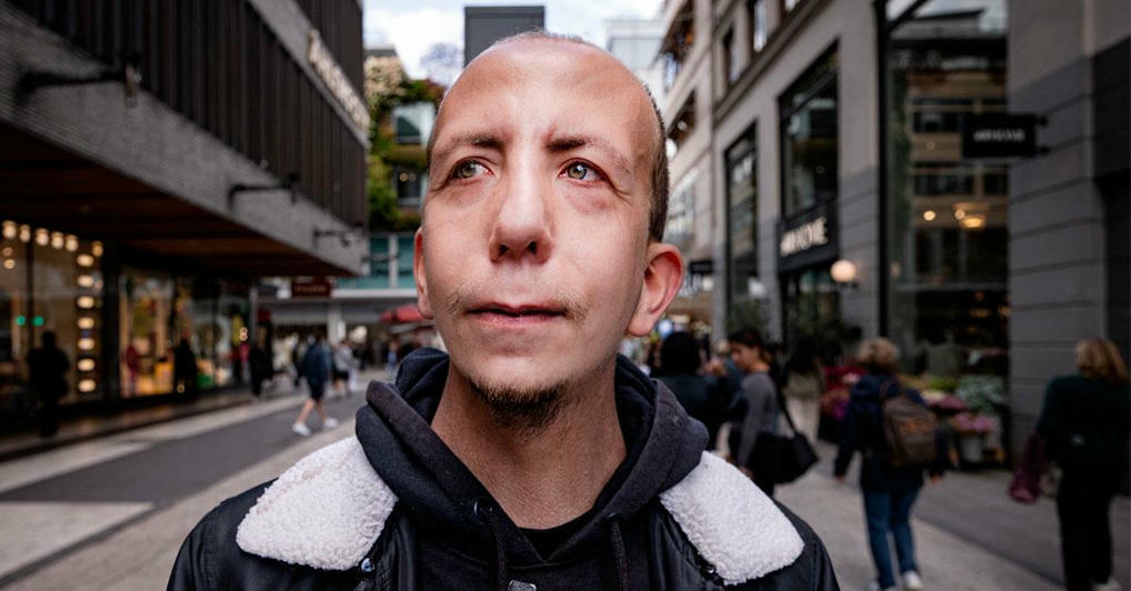 Tiktok-stjärnan Chicken nuggets-mannen lur...