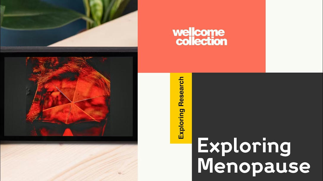 Exploring Menopause Through Collections and Col...