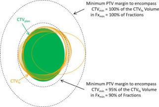 Empirical planning target volume modeling for h...