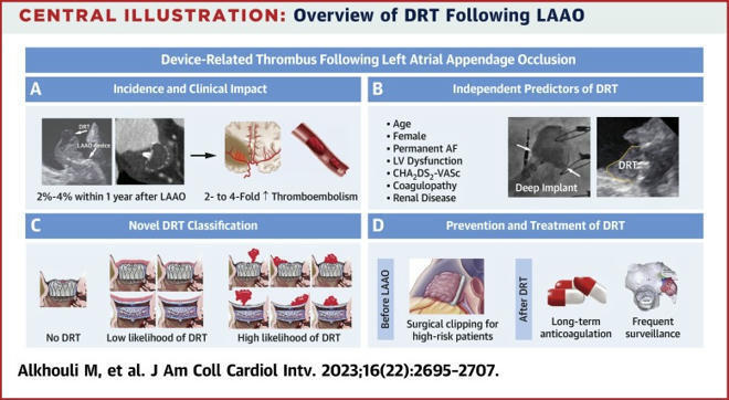Device-Related Thrombus After Left Atrial Appen...