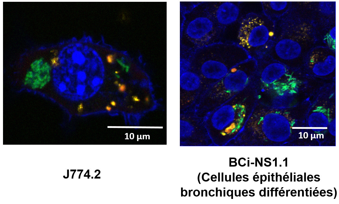 Colocalisation de l’amikacine liposomale ...