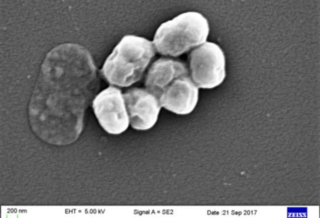 Découverte d'un nouvel antibiotique cont... Découverte d'un nouvel antibiotique cont...
