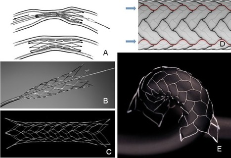 Enterprise stent for the treatment of symptomat...