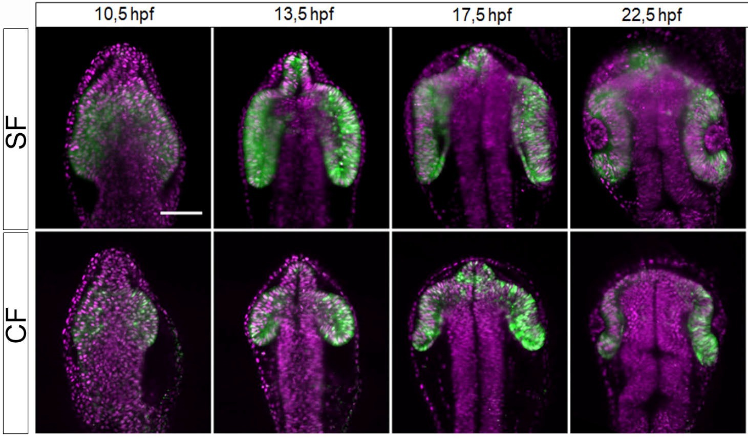 La morphogénèse de l’&oelig...