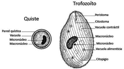 BALANTIDIASIS ó BALANTIDIOSIS- Recursos ...