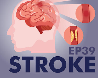 What is Stroke and its causes? – | Neurov...
