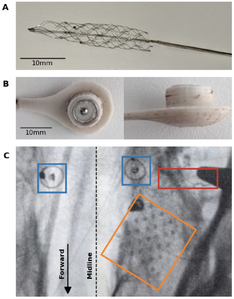 Comparison of Sub-Scalp EEG and Endovascular St...