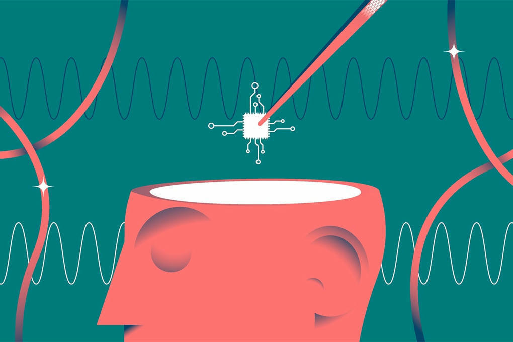 Neuralink’s First User Describes Life wit...