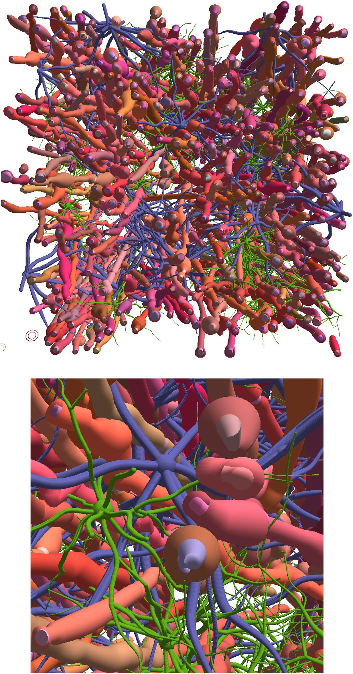 NeuroSpin combine IRM et Intelligence Artificie...