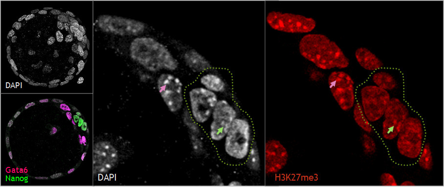 L'hétérochromatine de l'embryon p...