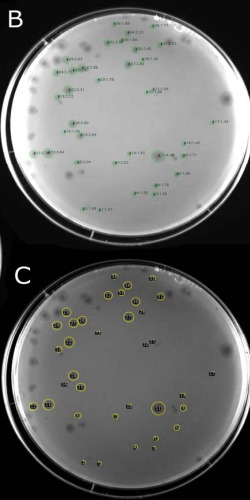 Plaque Size Tool: an automated plaque analysis ...
