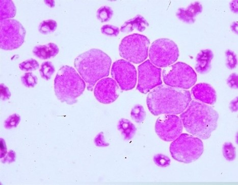 Analyzing Myeloid Cells Using Flow Cytometry