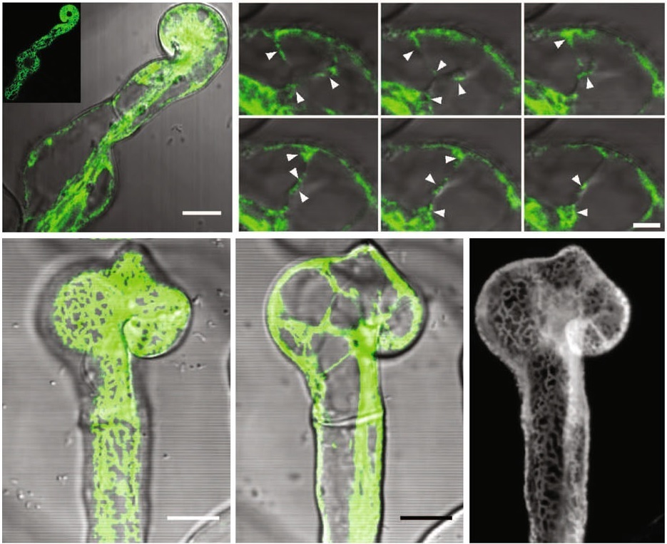 Endoplasmic reticulum-targeted GFP reveals ER r...