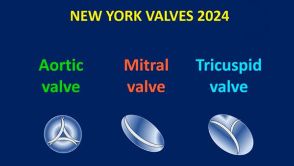 New York Valves 2024: Everything you need to kn...