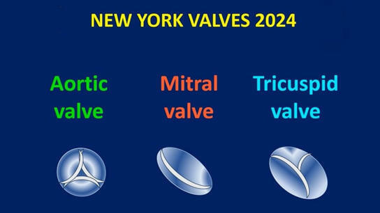 New York Valves 2024: Everything you need to kn...