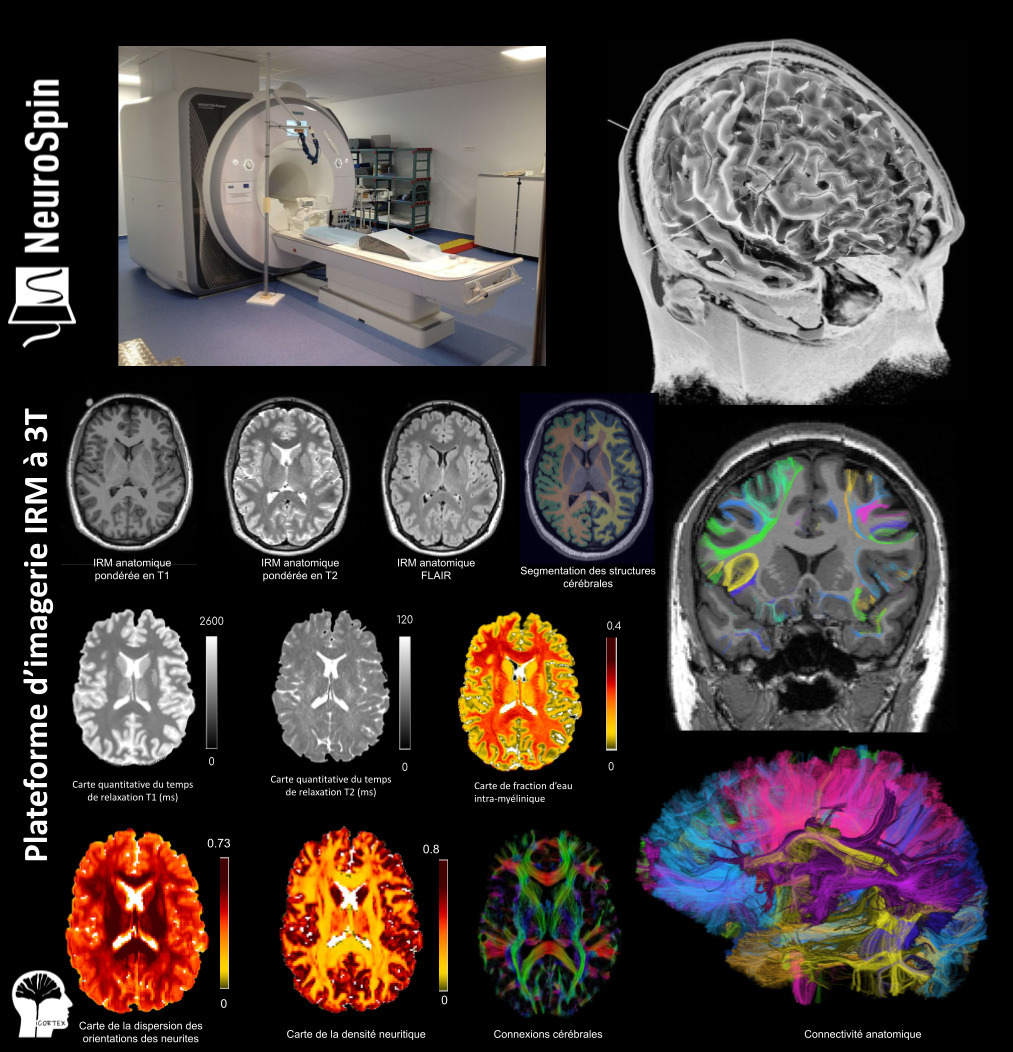 FOCUS PLATEFORME : A NeuroSpin, le phéno...