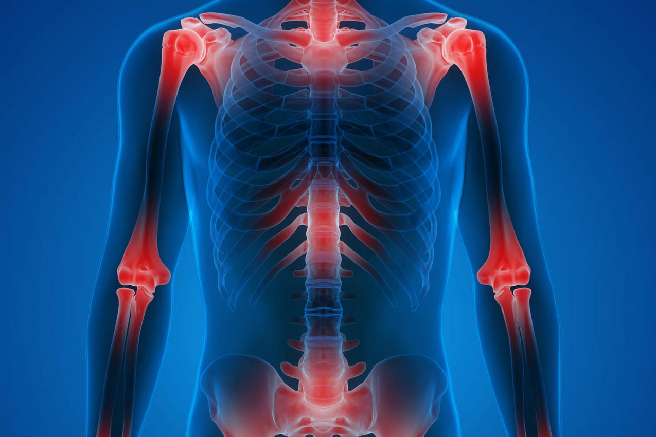 #Sarcome : tout savoir sur le #cancer des tissu...