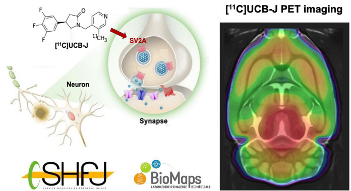 FOCUS PLATEFORME : [11C]UCB-J / SV2A, ou l&rsqu...