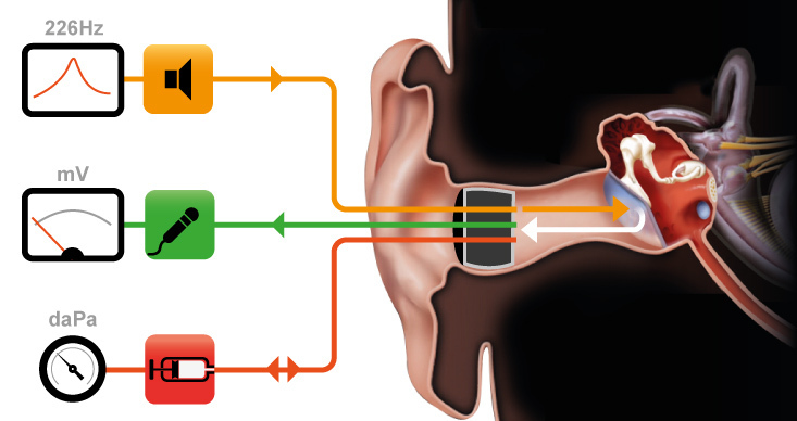 Estudio del reflejo estapedial en patolog&iacut...
