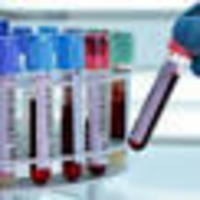 Full Medical Check up Package: Understanding th...