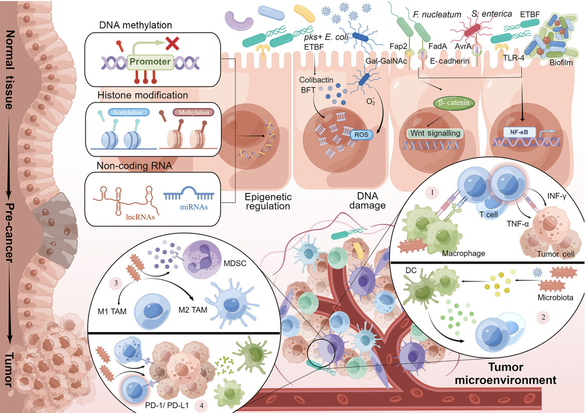 Microbiome-driven anticancer therapy: A step fo...