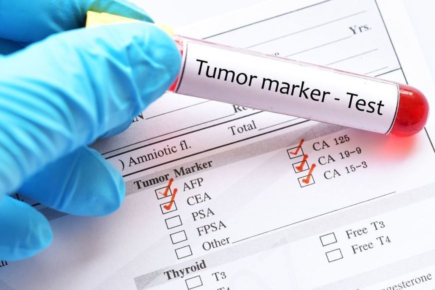 Un nouveau traitement pour le #cancer du pancr&...