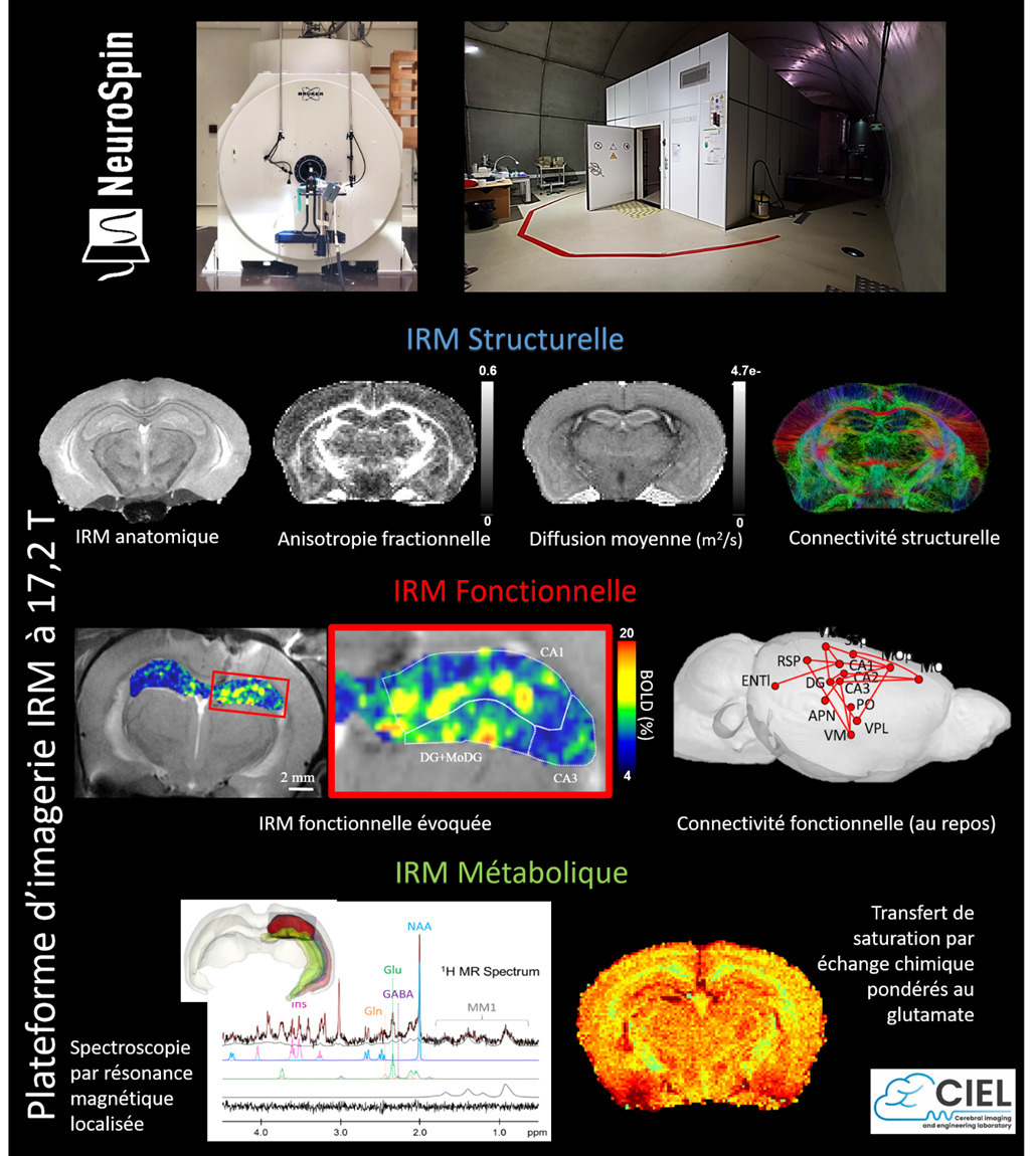 FOCUS PLATEFORME : TopBrainx17 : NeuroSpin r&ea...